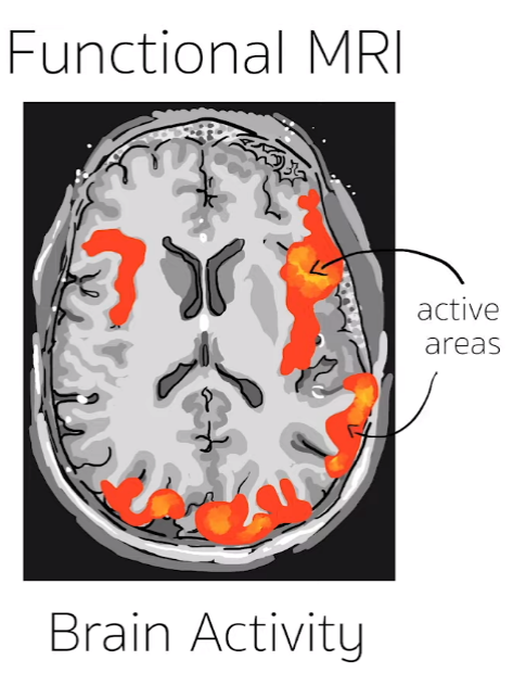 7T MRI Technology - Public Engagement