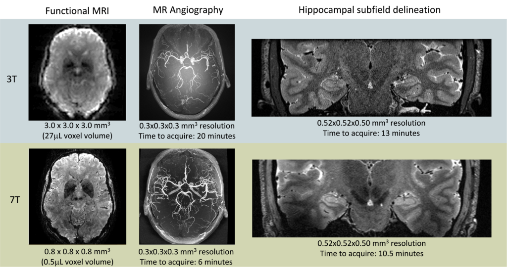 3T MRI Technology - Public Engagement